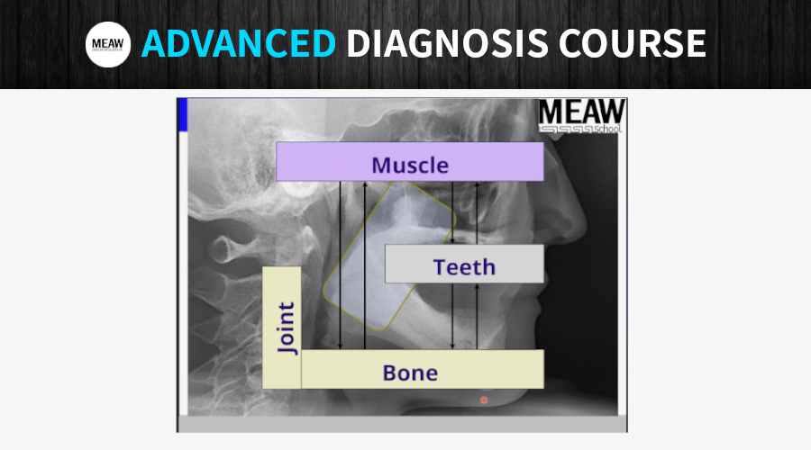 1. Causes of Malocclusion: Introduction